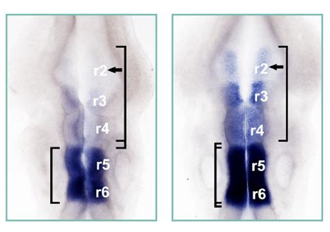Reuniting Babies And Their Bottles Gw Magazine The George