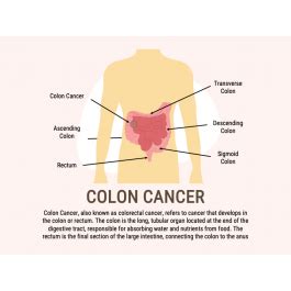 Colon Cancer Powerpoint And Google Slides Template Ppt Slides