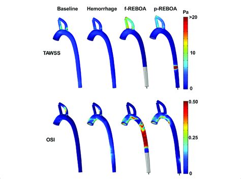 Shear Stress And Oscillatory Shear Index From The Cfd Simulations