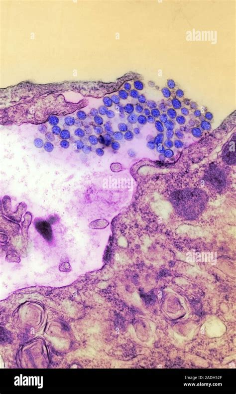 Hantavirus Infection Coloured Transmission Electron Micrograph Tem