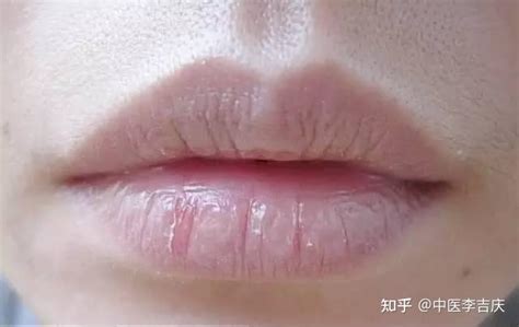 中医说：气虚、血虚、阴虚、阳虚，区别在哪里？ 知乎
