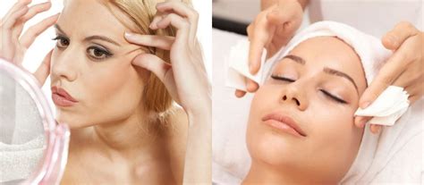 Cinco Trucos De Belleza Para Deshacerse De La Flacidez Del Rostro