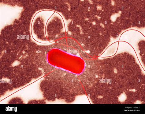 Coloured Transmission Electron Micrograph Tem Of An Escherichia Coli O157 Bacterium E Coli