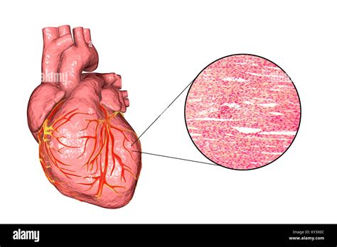 Computer Illustration Of A Human Heart And Light Micrograph Of Heart Muscle Heart Muscle Is