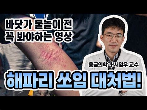 매년 증가하는 해파리 쏘임 사고 바닷가 물놀이 전에 대처법 숙지하기feat 응급의학과 서영우 교수 대구가톨릭대병원