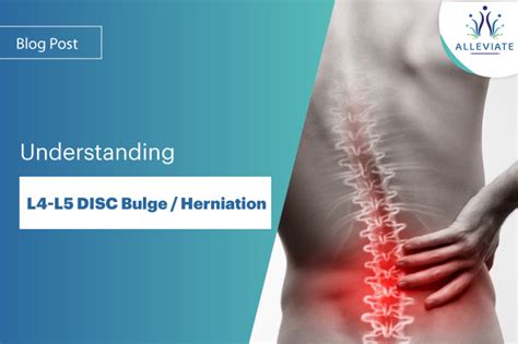 L4 L5 Disc Bulge And Herniation Symptoms Investigations Treatment