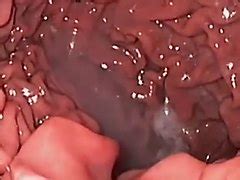 Endoscope Stomach Giantess Vore Full Tour ThisVid