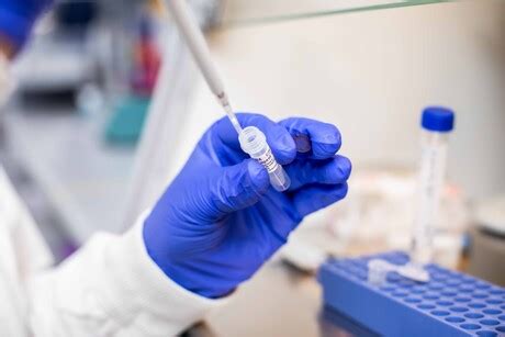 Liquid Reagent Inactivates SARS CoV 2 In Patient Samples