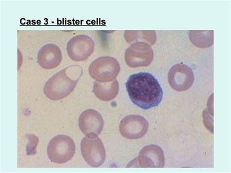 Medical Science Hematology Medical