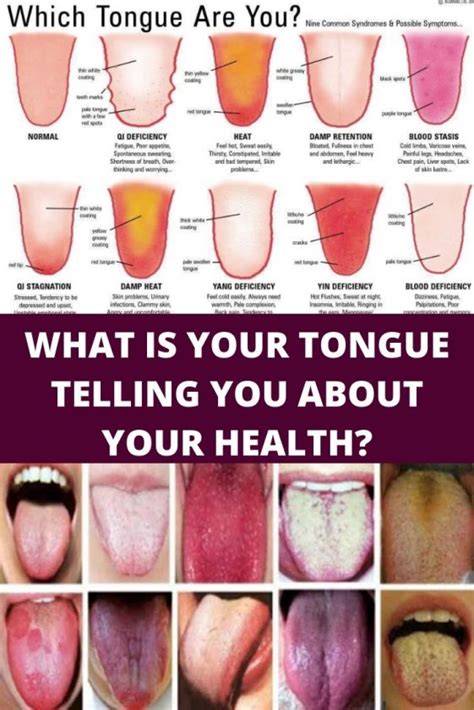 What Is Your Tongue Telling You About Your Health Yoga4daily