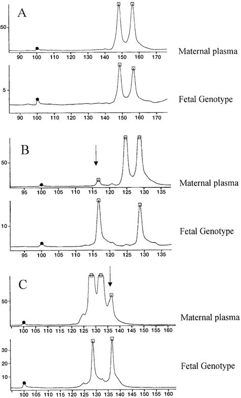 Detection Of Fetal Derived Paternally Inherited X Chromosome Str