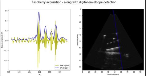 a hsdk for ultrasound imaging piday raspberrypi raspberry pi