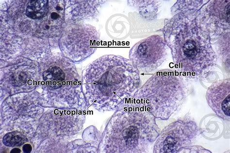 Metaphase Microscope