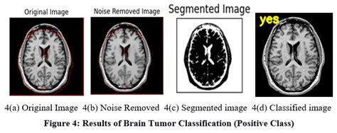 Real Time Multi Fractal Ensemble Analysis Cnn Model For Optimizing
