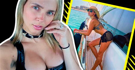 Elizabeth Loaiza Muestra La Terrible Cicatriz Que Atraviesa Sus Glúteos