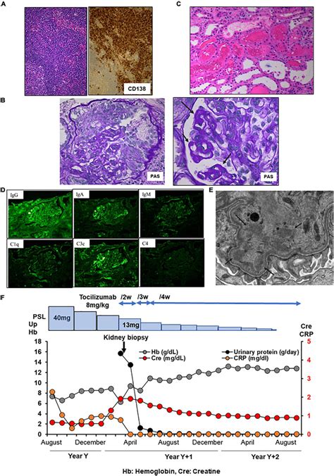 Histology And Time Course For Case 2 A Light Micrograph Of The Lymph