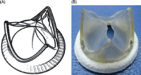 3 The Next Generation Of Artificial Heart Valves A Tri Leaflet