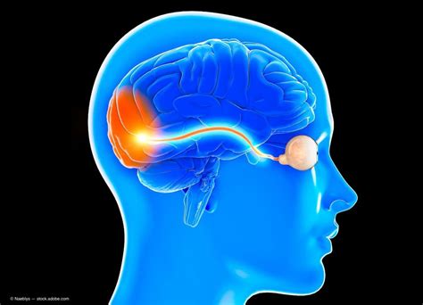 What Ophthalmologists Need To Know About Neuromyelitis Optica Spectrum