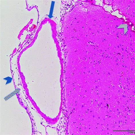 A Section Of Brain Surface Showing The Surrounding Subarachnoid Space Download Scientific
