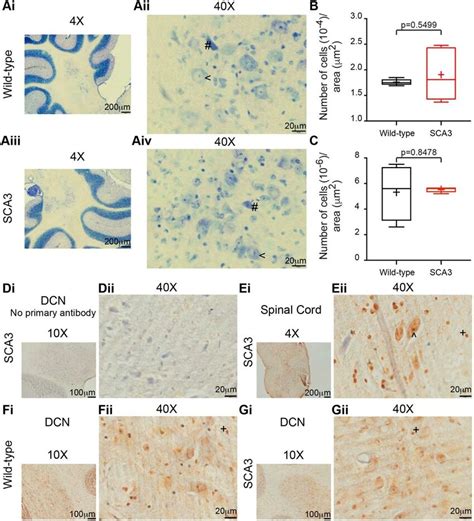 Lack Of Deep Cerebellar Nuclei Cell Death Or Ataxin 3 Intranuclear Download Scientific Diagram