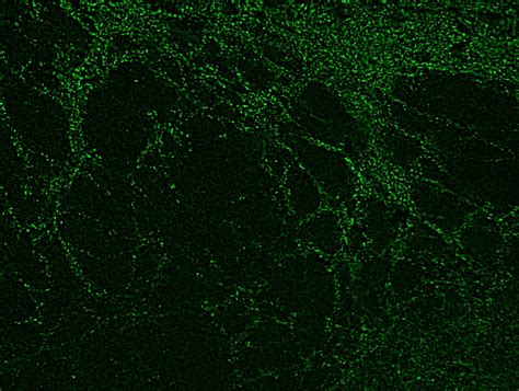 Images Not Opening In Jacop Imagej Researchgate Images Not Opening In Jacop Imagej Researchgate