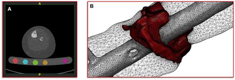 illustration of the segmentation image processing and meshing