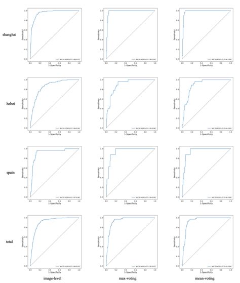 COVID 19 Vs Non COVID 19 ROC Curves On The Test Datasets Of Shanghai