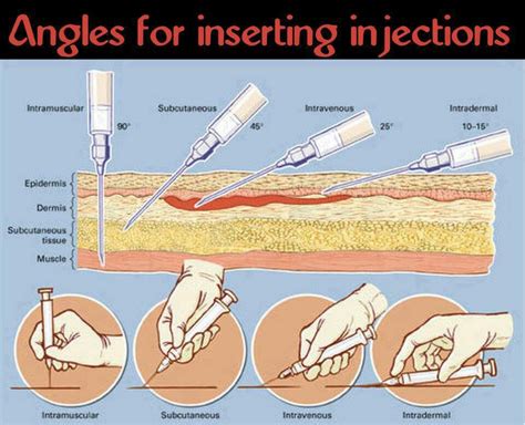 1000 Images About Cattle Health On Pinterest