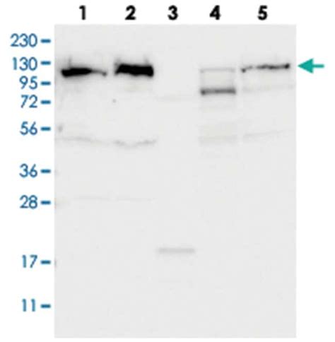 Anti Iars2 Antibody 100ul