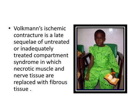 Volkmann¶s Ischemic Contracture Ppt