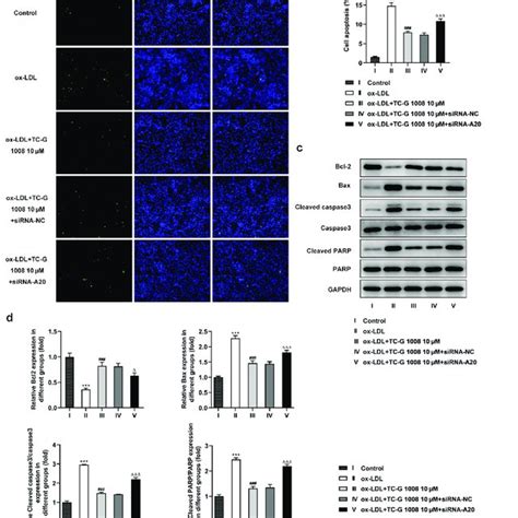 Gpr39 Reduced Ox Ldl Induced Macrophage Apoptosis Via Inducing A20