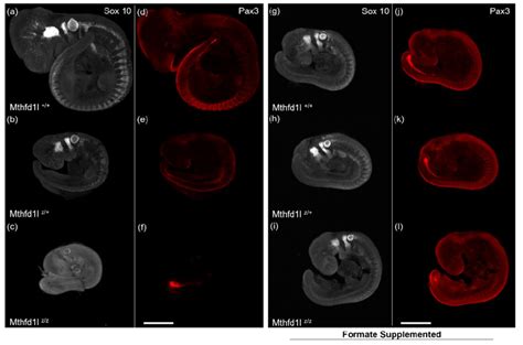 Mthfd1l Ablation Disrupts Neural Crest Cell Migration And Somitogenesis