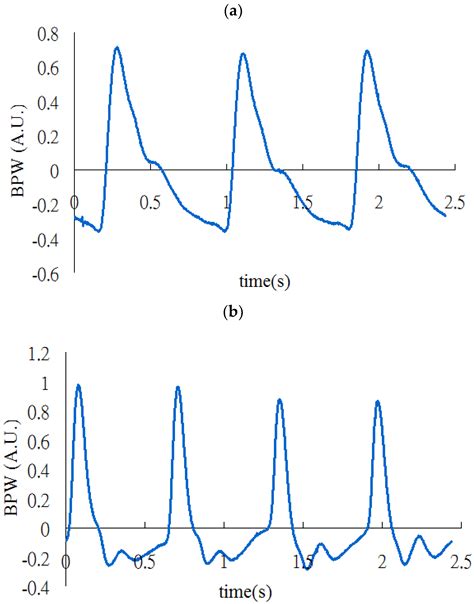 Machine Learning Classification Of Pulse Waveform Quality
