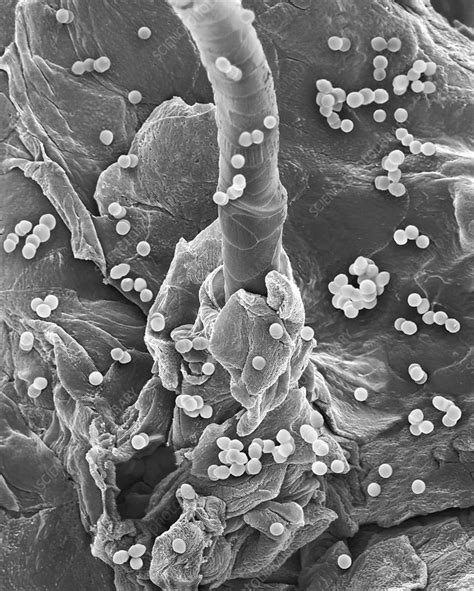 Enterococcus Faecium On Human Skin Sem Stock Image C0370079