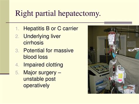 Ppt Preoperative Assessment Powerpoint Presentation Free Download Id6194229 Ppt Preoperative Assessment Powerpoint Presentation Free Download Id6194229
