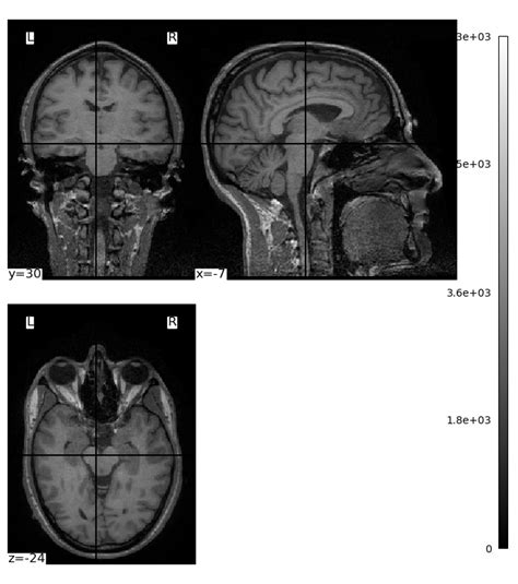 Working With Nifti Images — Neural Data Science In Python