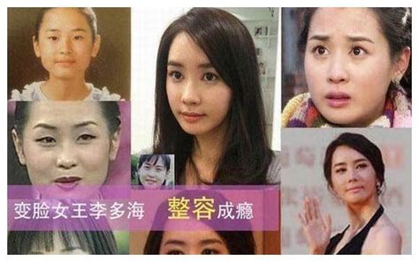 《我的女孩》：李多海步入整容不归路，他事业高峰，他却不幸身亡