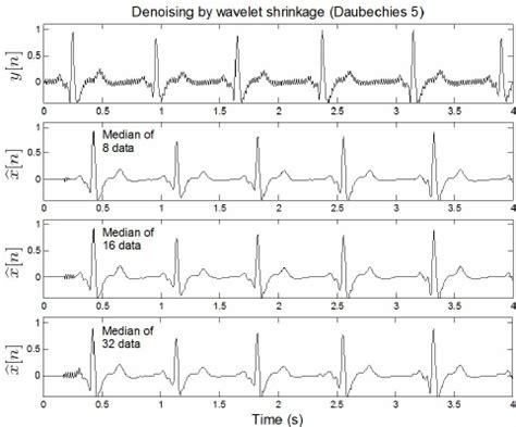 Results Of The Wavelet Based Denoising Architecture Obtained With