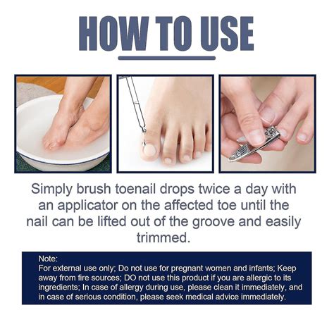 Toenailcare Removal Paronychia Oil German Toenailplus Anti Paronychia