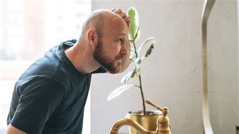 Reasons Why Men Go Bald Fast