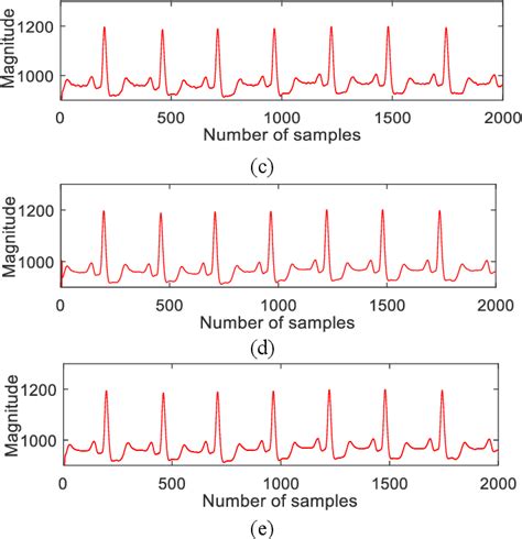Figure 1 From Muscle Noise Cancellation From Ecg Signal Using Self Correcting Leaky Normalized