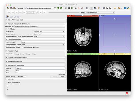 How To Use Resample Scalarvectordwi Volume Support 3d Slicer