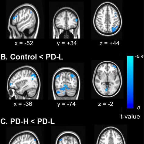 Comparison Of Cortico Cortical Functional Connectivity From The Download Scientific Diagram
