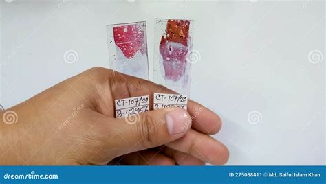 Doctor Holding Microscopic Glass Slide For The Diagnosis Of Cytology