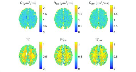 Examples Of Estimates Of Mean Diffusivity Top And W Bottom In Download Scientific