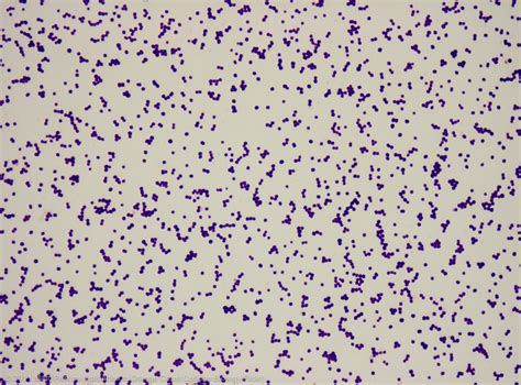 Staphylococcus Epidermidis Staphylococcus Epidermidis Wikipedia