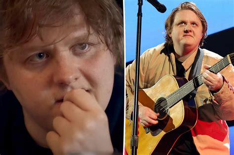 Lewis Capaldi Will Quit Music If Tourette Syndrome Worsens