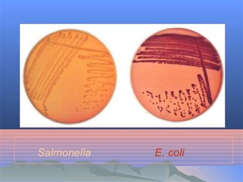 Lectures 15 17 Escherichia Coli Shigella Salmonella
