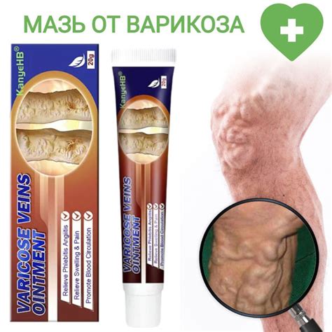 Крем от варикоза для ног - купить с доставкой по выгодным ценам в ...