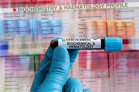 Tubo De Muestra De Sangre Para Análisis De Bioquímica Y Prueba De
